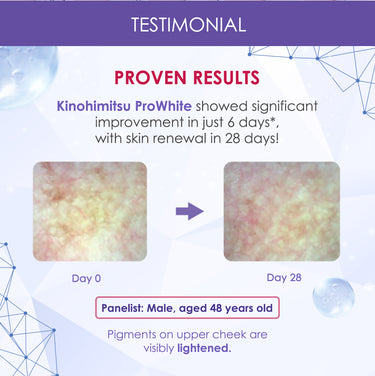 ProWhite – Kinohimitsu Singapore