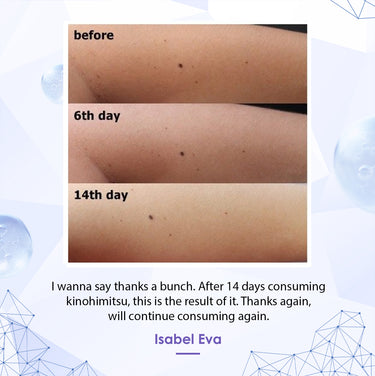 ProWhite – Kinohimitsu Singapore